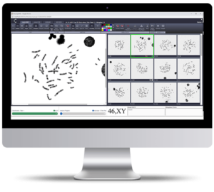 BioView – Karyotype AI